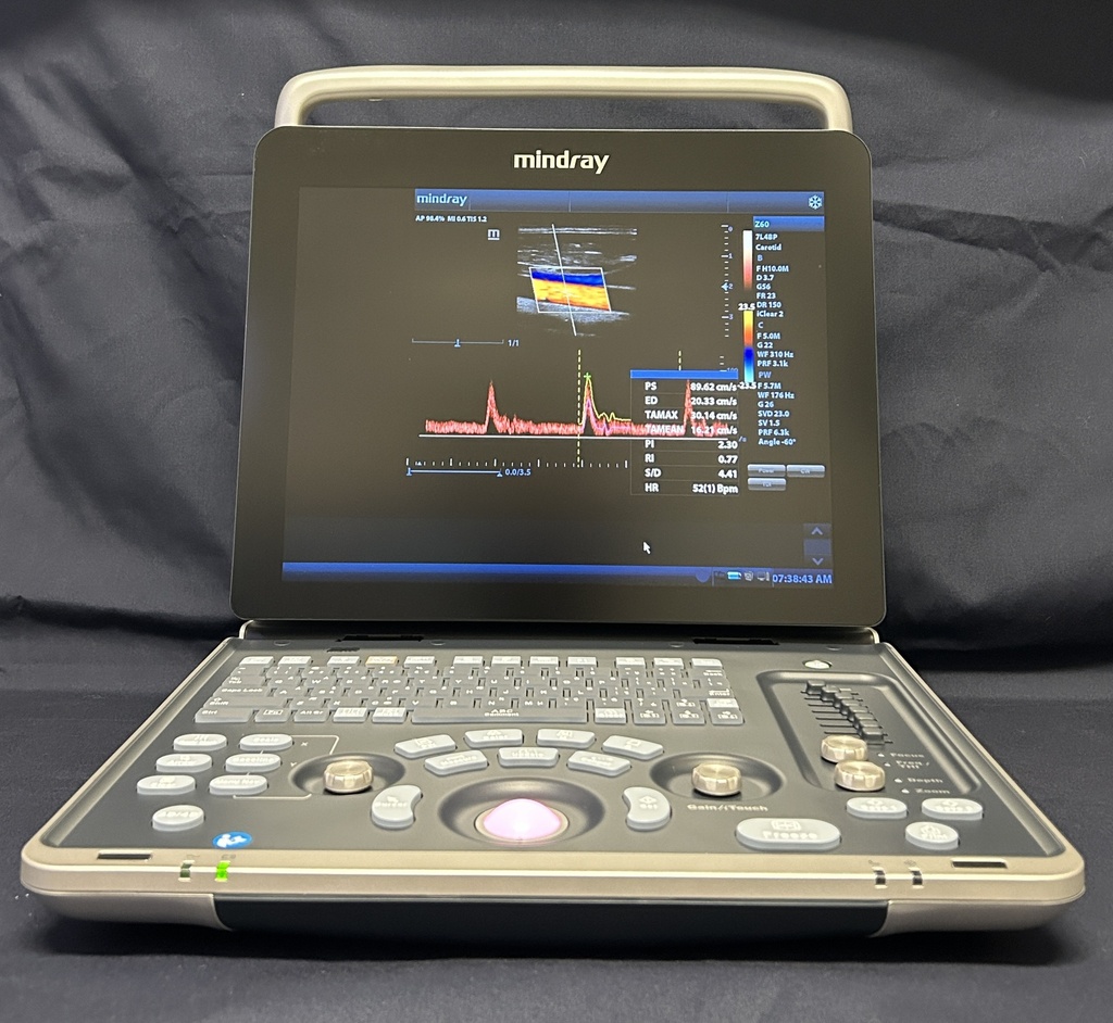 Mindray Z60 Colorflow Portable Ultrasound | Biomedical Main