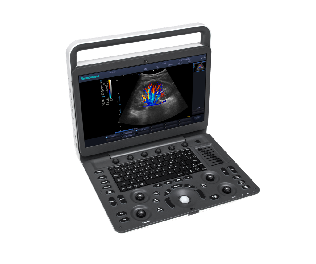 Sonoscape E2 Pro | Biomedical Main